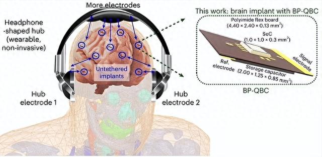 Ultra-miniature chip implanted in the brain, able to control computers ...